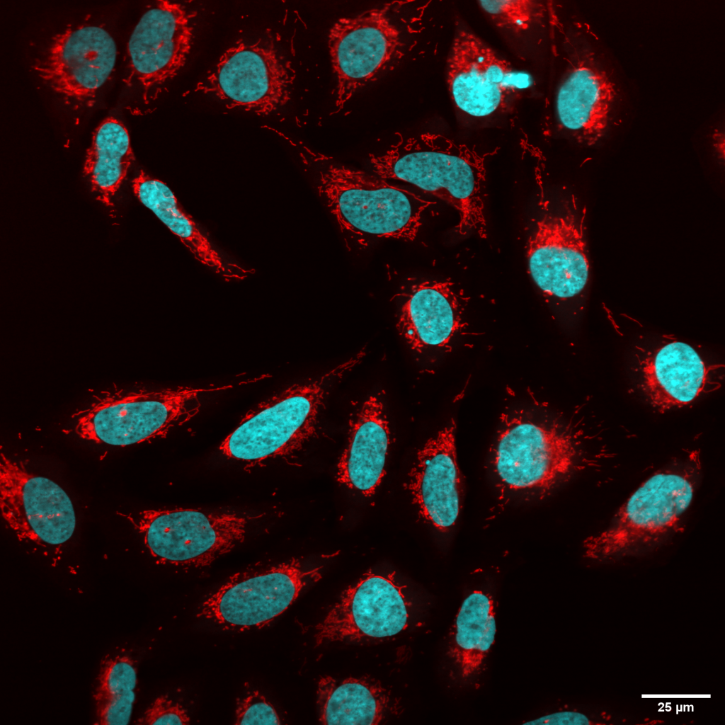 High content imaging with confocal microscopy | Bienta
