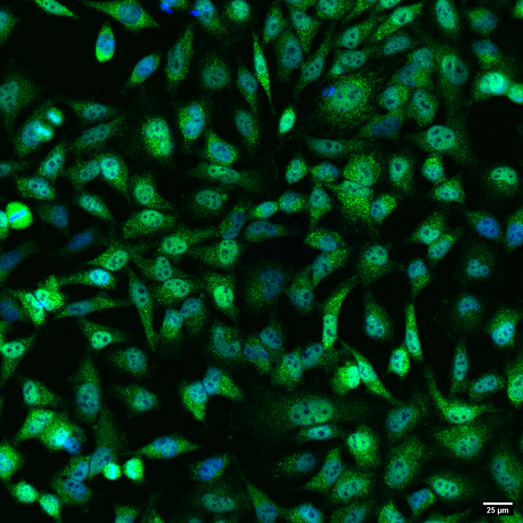 High content imaging with confocal microscopy | Bienta