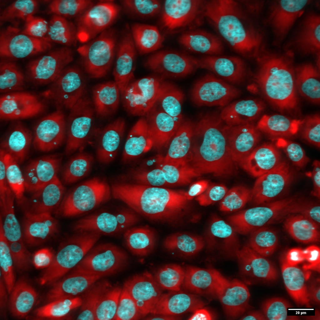 High content imaging with confocal microscopy | Bienta
